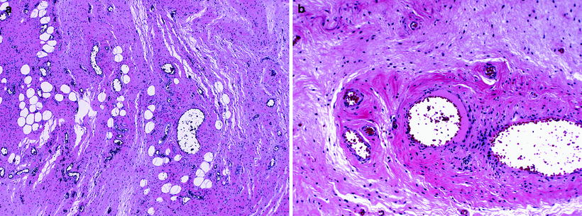 Lesions of the Vulva and Vagina | SpringerLink