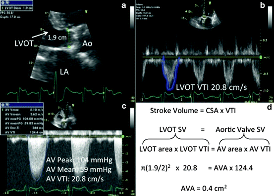 Valvular Heart Disease | SpringerLink