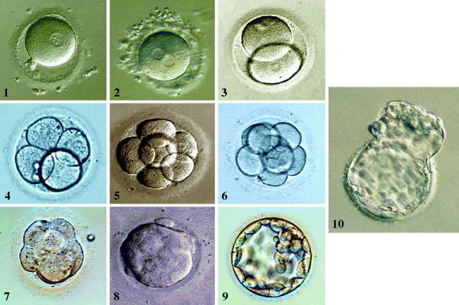 Human Embryo Culture and Assessment for the Derivation of Embryonic ...