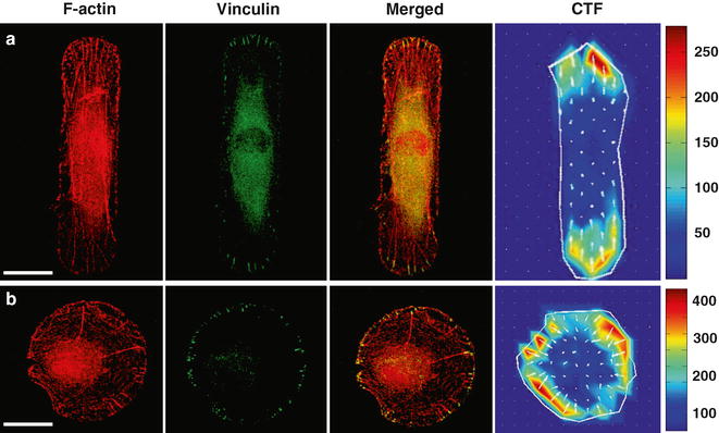 Application of Cell Traction Force Microscopy for Cell Biology Research ...