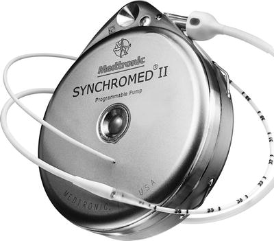 Intrathecal Drug Delivery by Implanted Pumps | SpringerLink