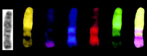 Multiplex Fluorescence in situ Hybridization (M-FISH) | SpringerLink