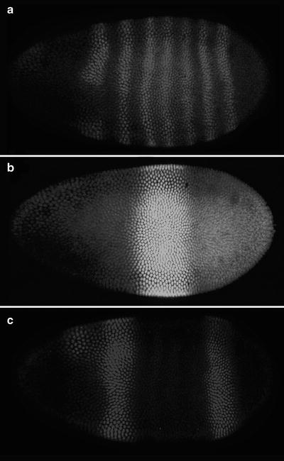 Laser Scanning Confocal Microscopy: History, Applications, and Related ...
