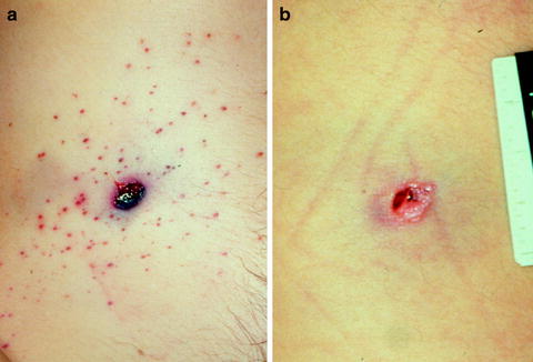 Forensic Pathology and the Investigation of Death | SpringerLink