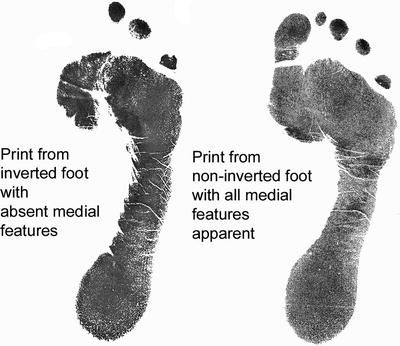 Bare Footprint Identification | SpringerLink