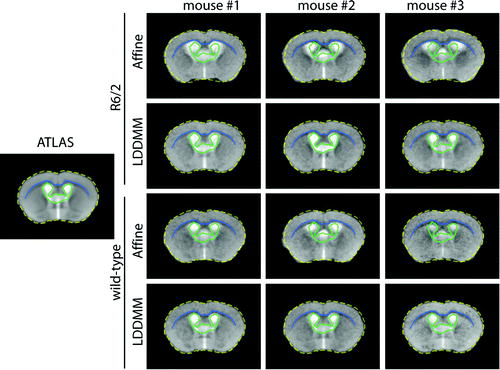 Magnetic Resonance Imaging-Based Mouse Brain Atlas and Its Applications | SpringerLink
