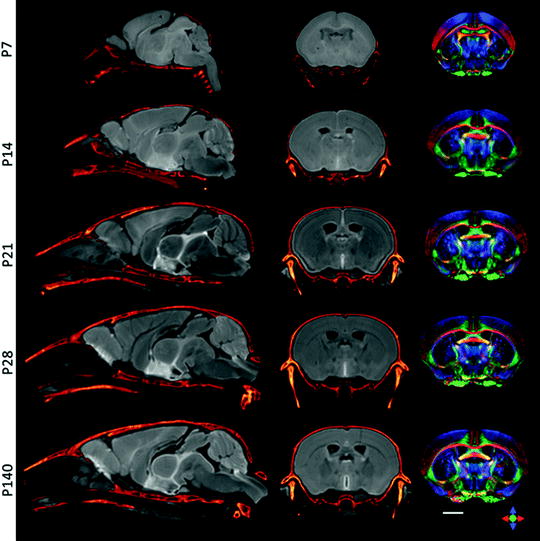 Magnetic Resonance Imaging-Based Mouse Brain Atlas and Its Applications | SpringerLink