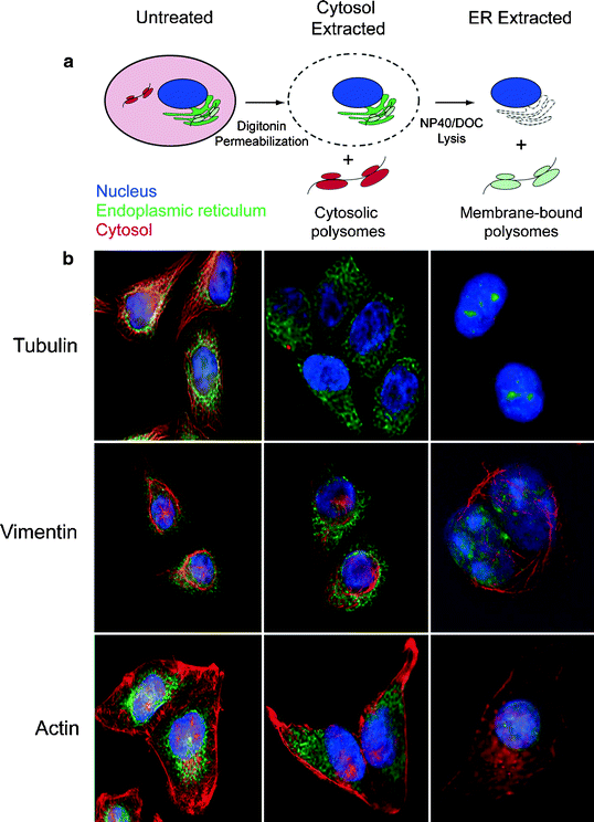 Analyzing mRNA Localization to the Endoplasmic Reticulum via Cell ...
