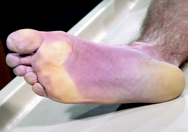 Asphyxial Deaths | SpringerLink