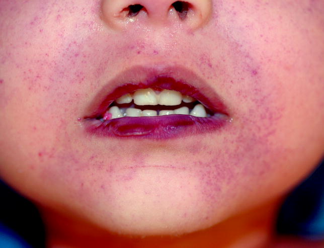 Postmortem Changes and Time of Death | SpringerLink