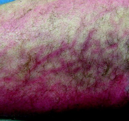 Postmortem Changes and Time of Death | SpringerLink