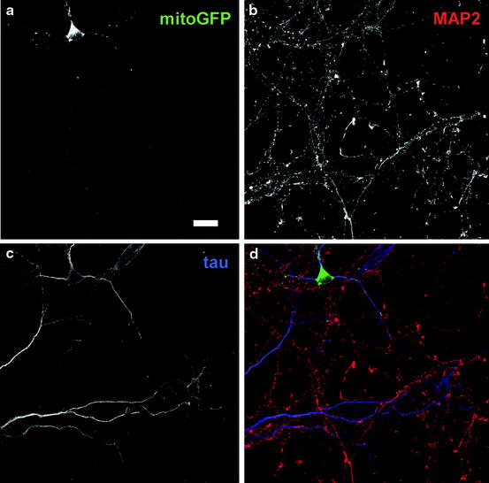 Isolation and Culture of Neurons and Astrocytes from the Mouse Brain ...