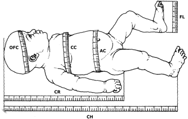 The Pediatric Autopsy | SpringerLink