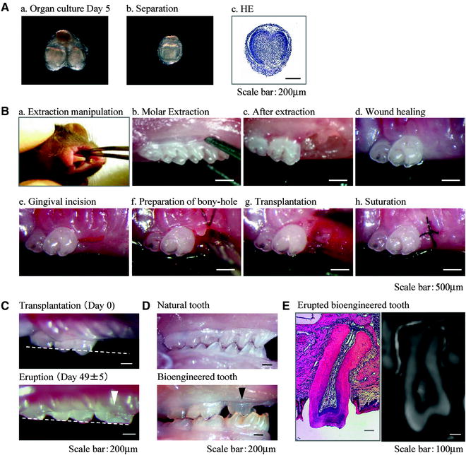 Generation of a Bioengineered Tooth by Using a Three-Dimensional Cell ...