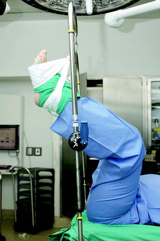 General Complications of Pelvic Reconstructive Surgery | SpringerLink