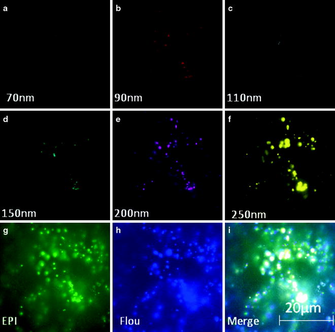 Total Internal Reflection Fluorescence (TIRF) Microscopy for Real-Time ...