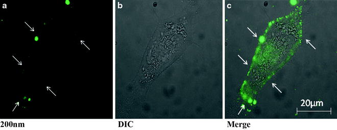 Total Internal Reflection Fluorescence (TIRF) Microscopy for Real-Time ...
