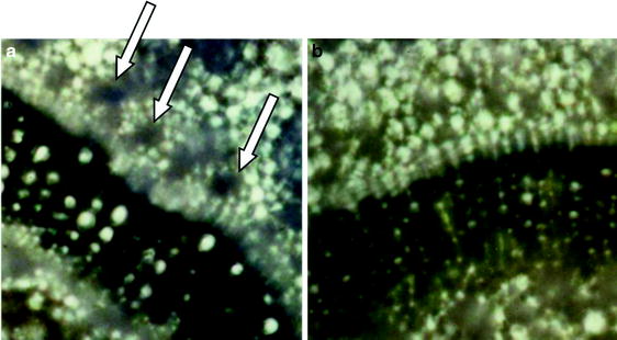 Dienes’ Staining and Light Microscopy for Phytoplasma Visualization ...