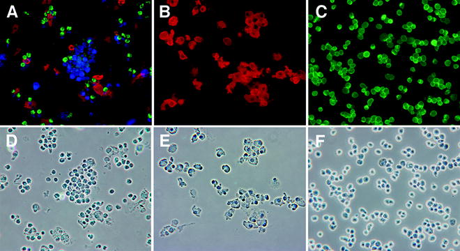 Isolation and Culture of Alveolar Epithelial Type I and Type II Cells ...