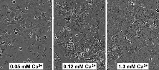 Mouse Epidermal Keratinocyte Culture | SpringerLink