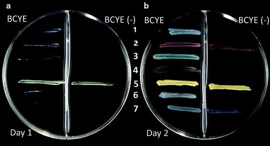 Identification of Legionella in the Environment | SpringerLink