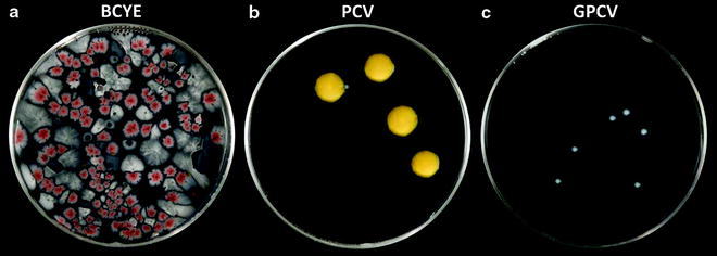 Identification of Legionella in the Environment | SpringerLink