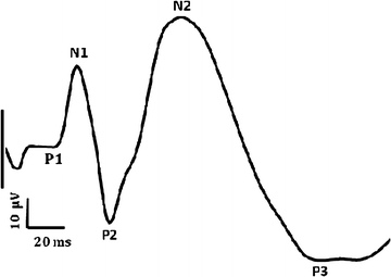 Visual Evoked Potential Recording in Rodents | SpringerLink