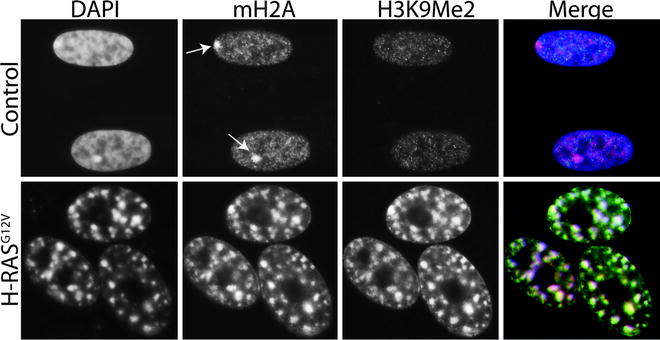 Detection of Senescence-Associated Heterochromatin Foci (SAHF ...