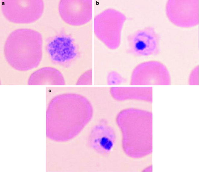 Platelet Morphology Analysis | SpringerLink
