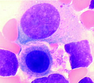 Platelet Morphology Analysis | SpringerLink
