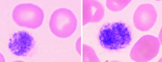 Platelet Morphology Analysis | SpringerLink