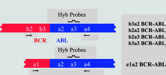 Quantitative BCR-ABL1 RQ-PCR Fusion Transcript Monitoring in Chronic ...