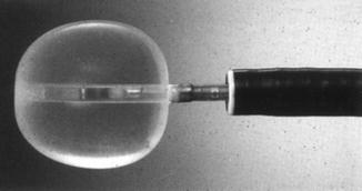 Radial Probe Endobronchial Ultrasound | SpringerLink
