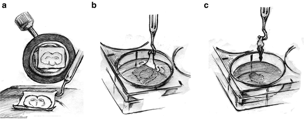 Cryosectioning | SpringerLink