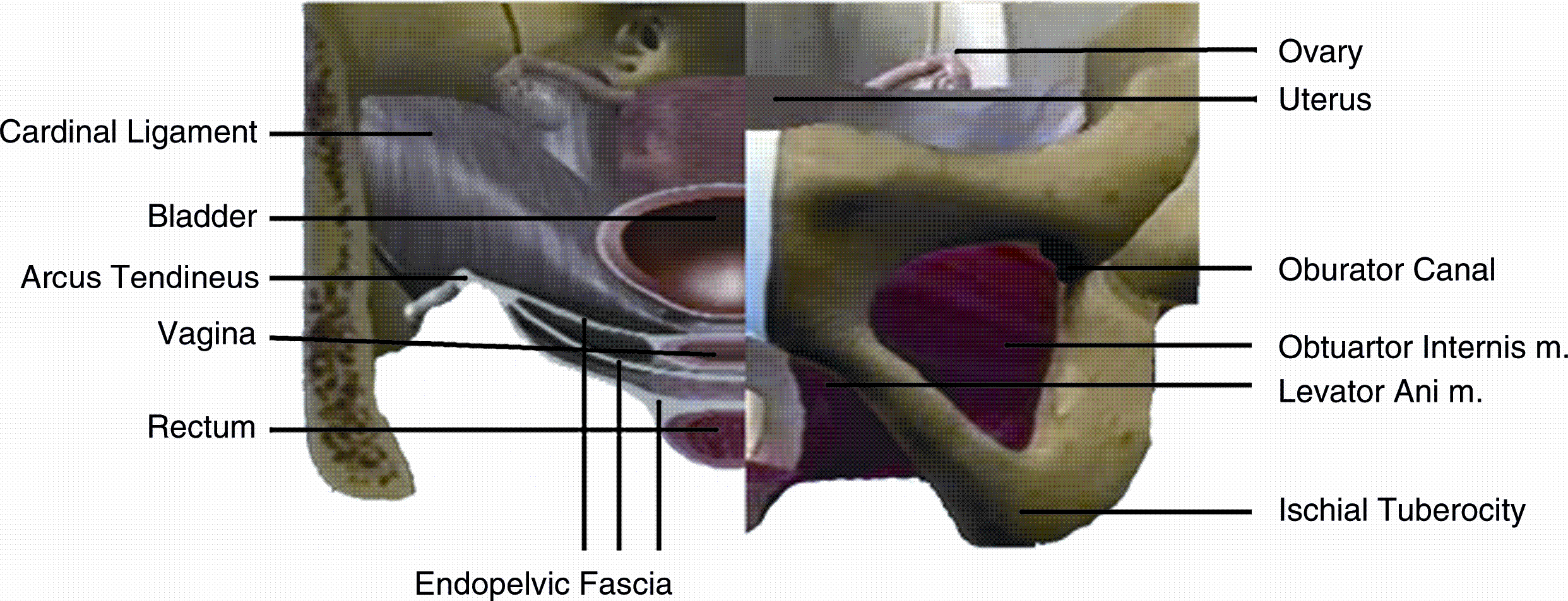 Pelvic Floor: Three-Dimensional Surgical Anatomy | SpringerLink