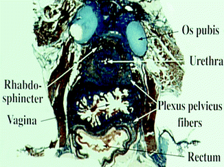 Gross and Laparoscopic Anatomy of the Lower Urinary Tract and Pelvis ...