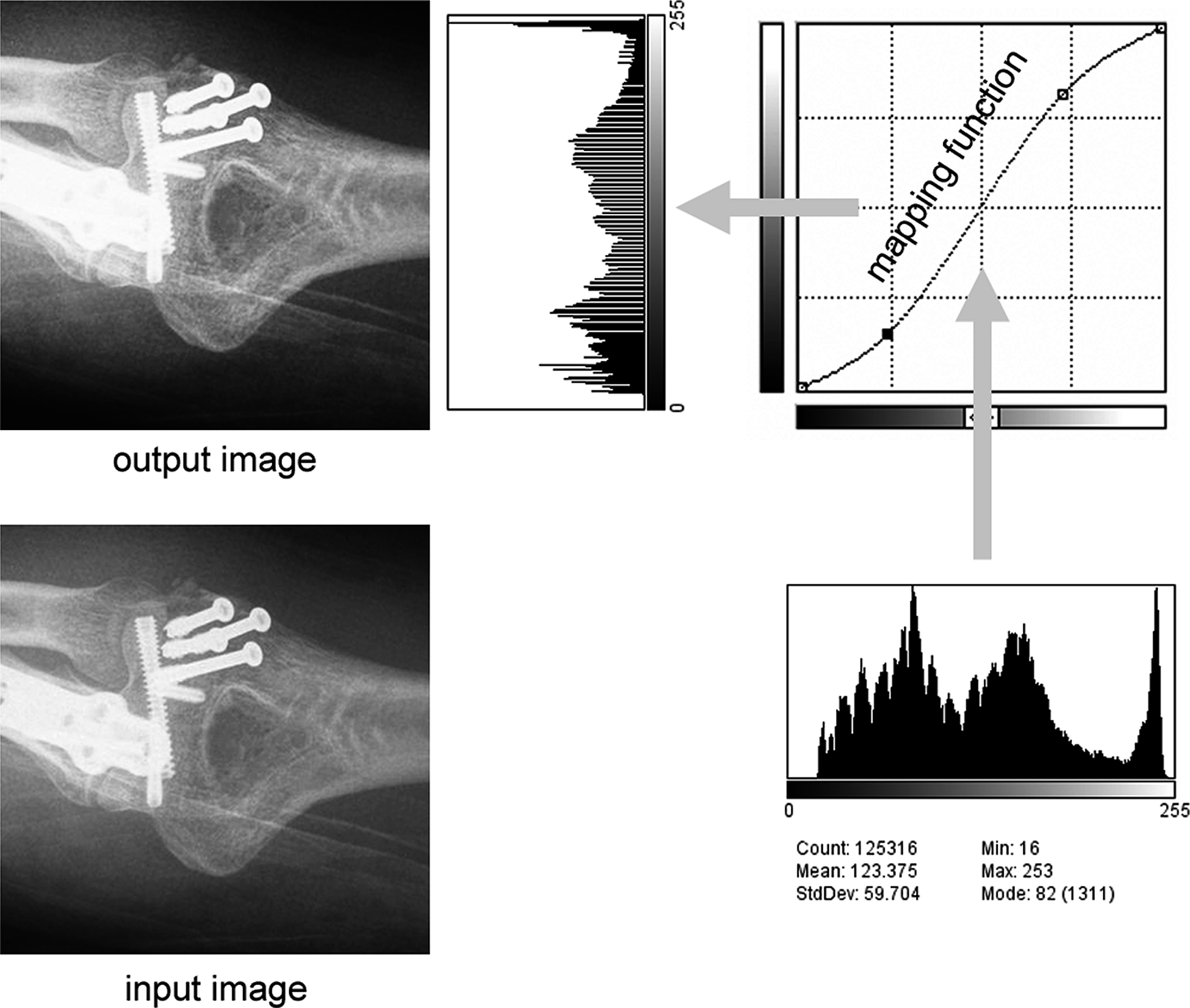 Contrast Adjustment | SpringerLink
