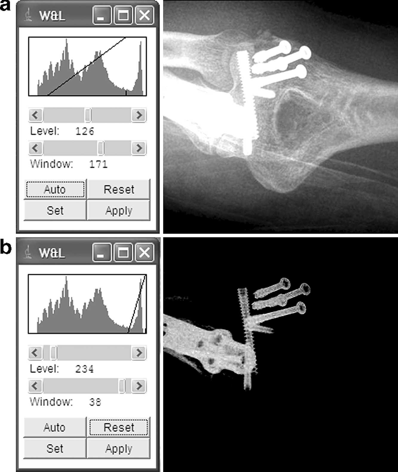 Contrast Adjustment | SpringerLink