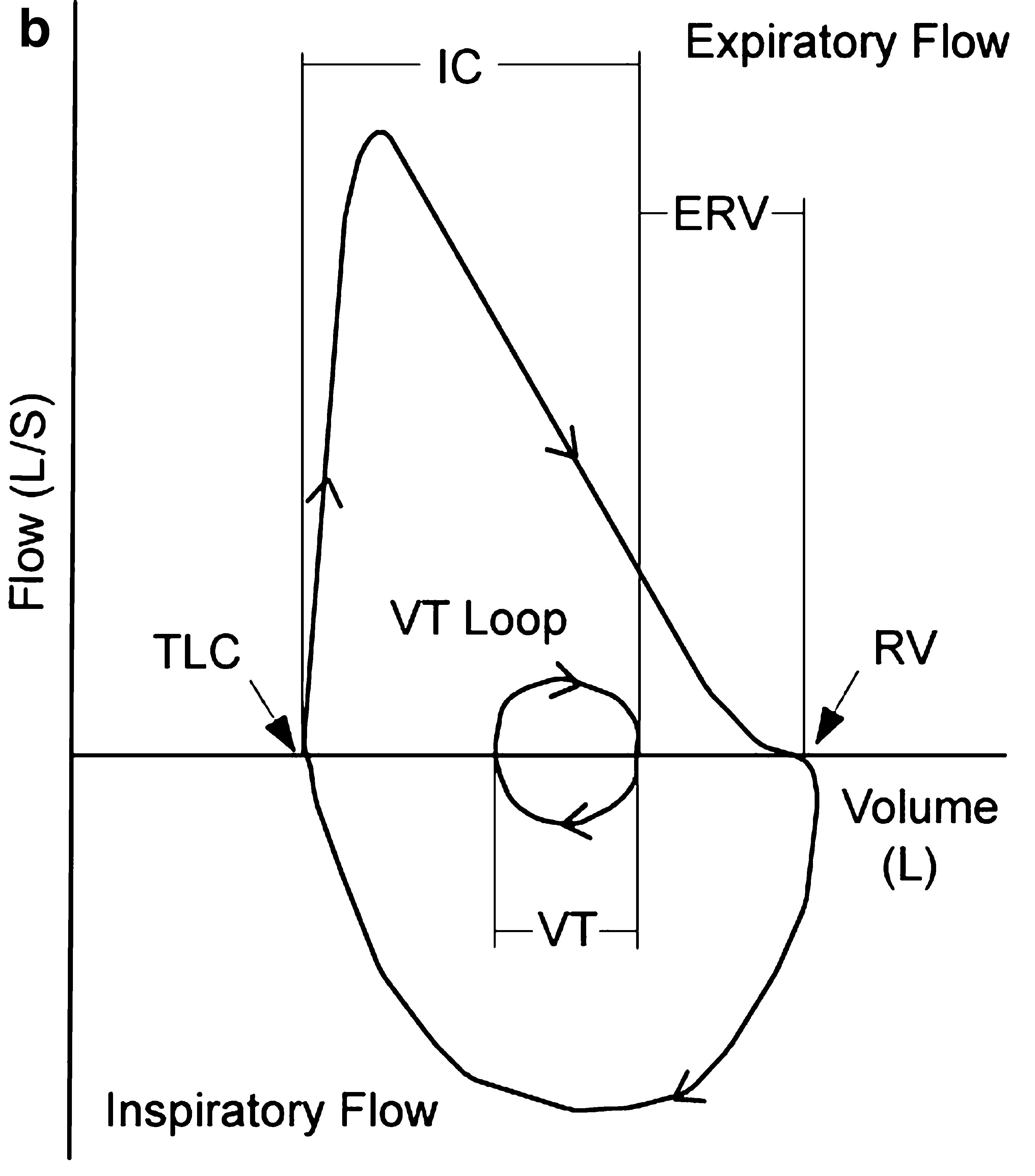 Spirometry | SpringerLink