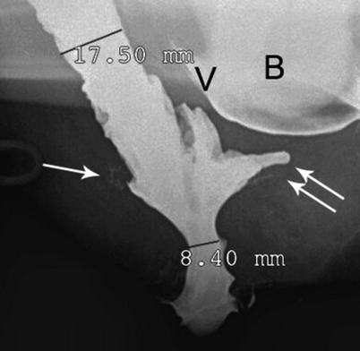 Defecography | SpringerLink
