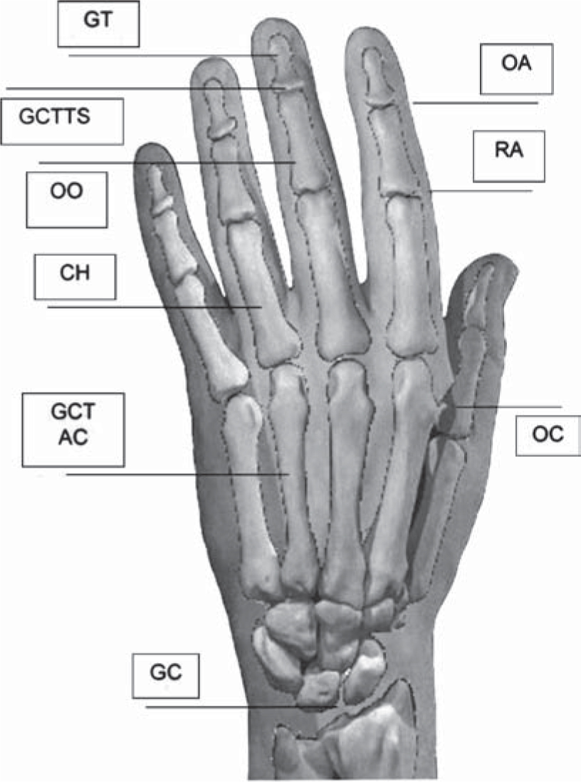 Benign and Malignant Hand Tumors | SpringerLink