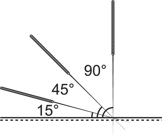 Techniques of Acupuncture and Moxibustion | SpringerLink
