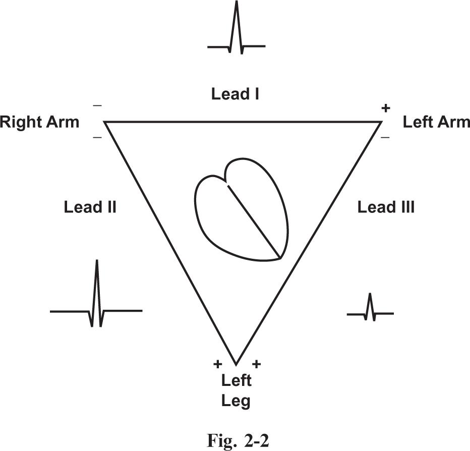 ECG Leads | SpringerLink