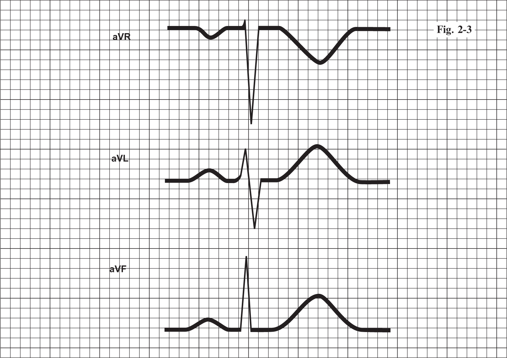 ECG Leads | SpringerLink