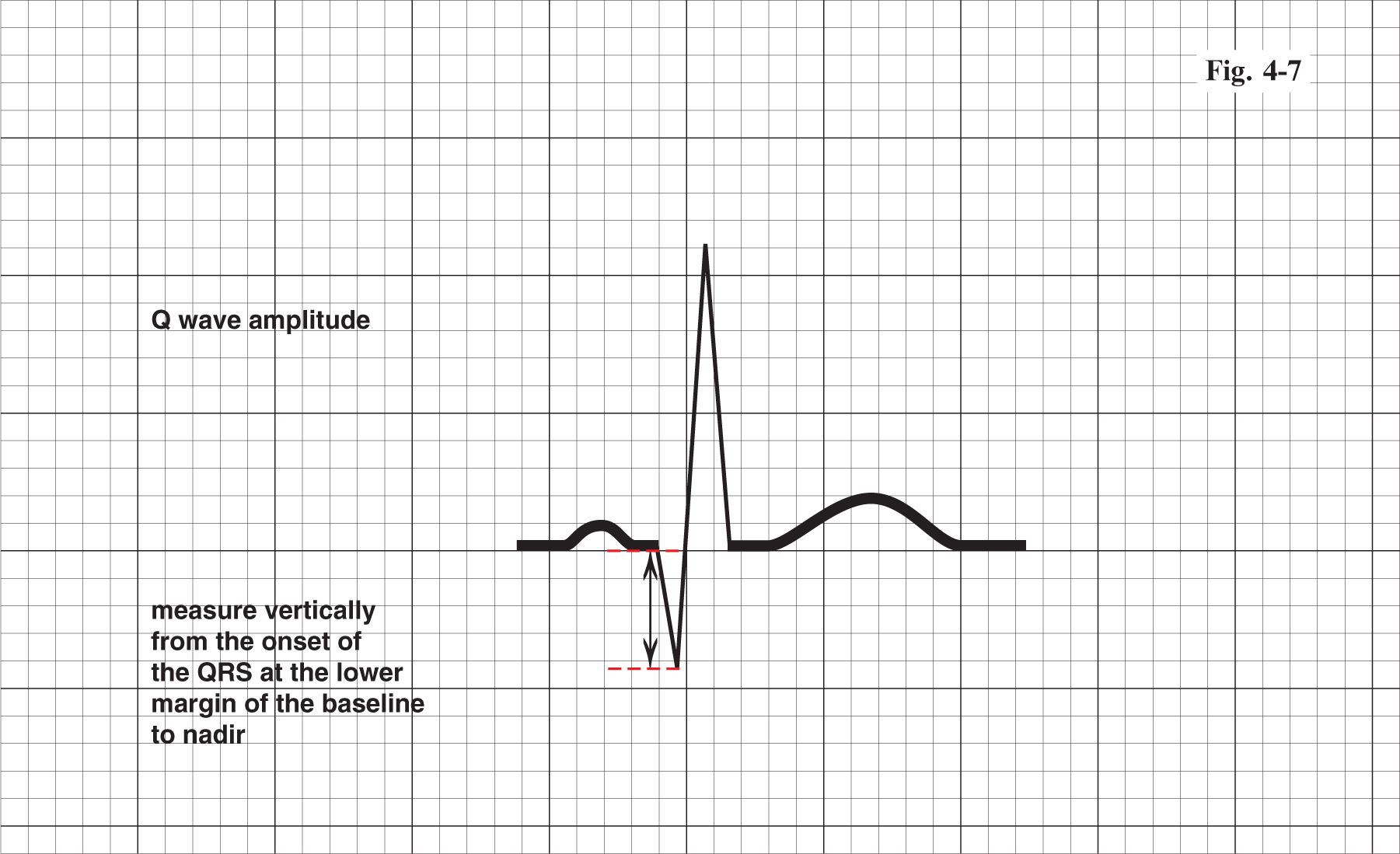 Q-QS Waves (1-Codes) | SpringerLink