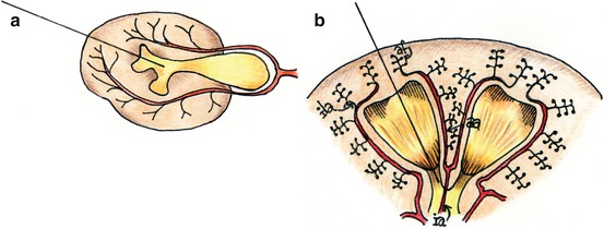 Anatomy for PNL | SpringerLink