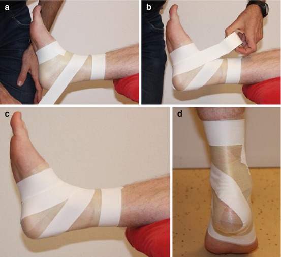 Taping Techniques and Braces in Football | SpringerLink