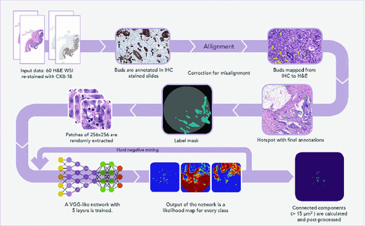 Automatic Detection Of Tumor Budding In Colorectal Carcinoma With Deep