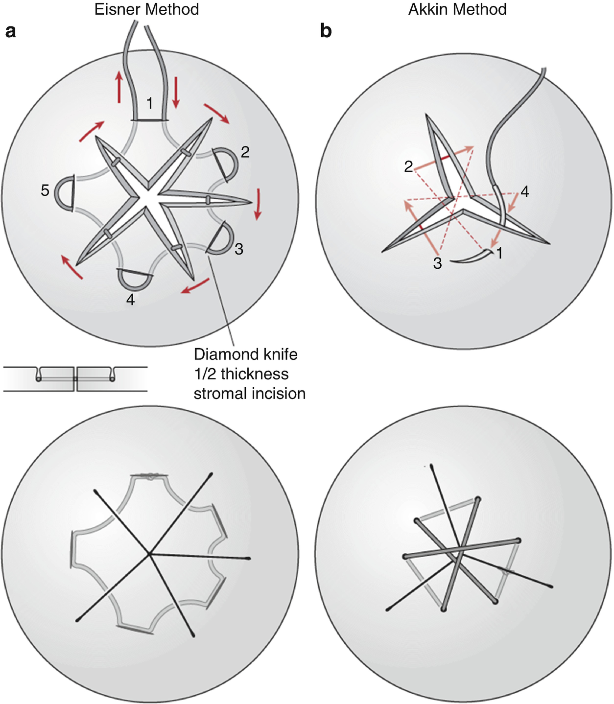 Damage Control Surgery: Blast—Anterior Segment Trauma | SpringerLink