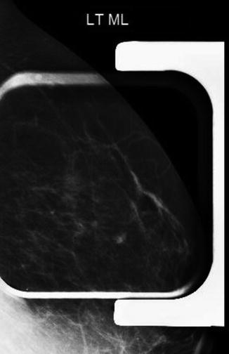 Magnification and Compression Views | SpringerLink